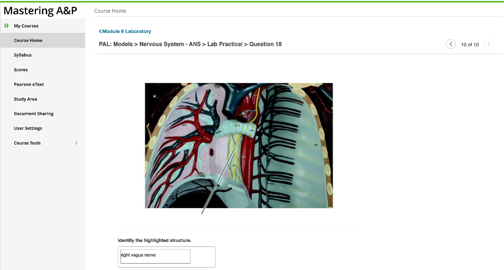 Solved Nervous System - ANS > Lab Practical > Question 18 | Chegg.com