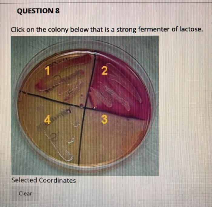 Solved QUESTION 7 Below is an EMB plate. Click on the | Chegg.com
