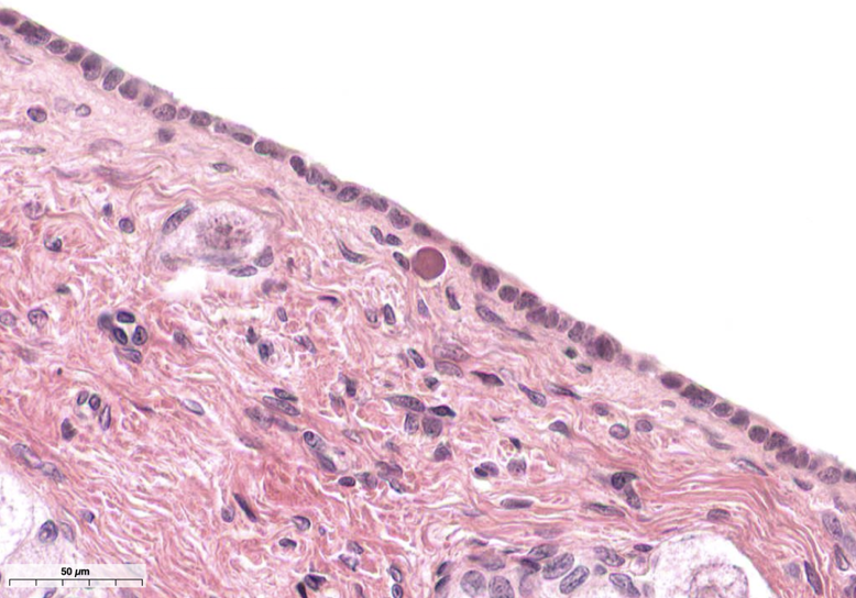 Solved This is a picture of Simple Cuboidal Epithelium, | Chegg.com