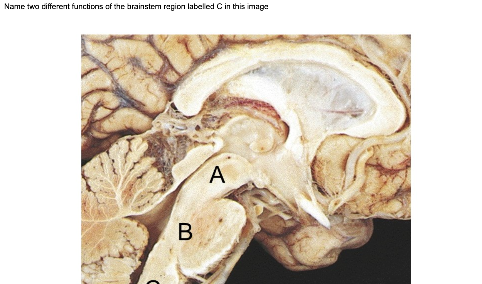 Solved Name two different functions of the brainstem region | Chegg.com