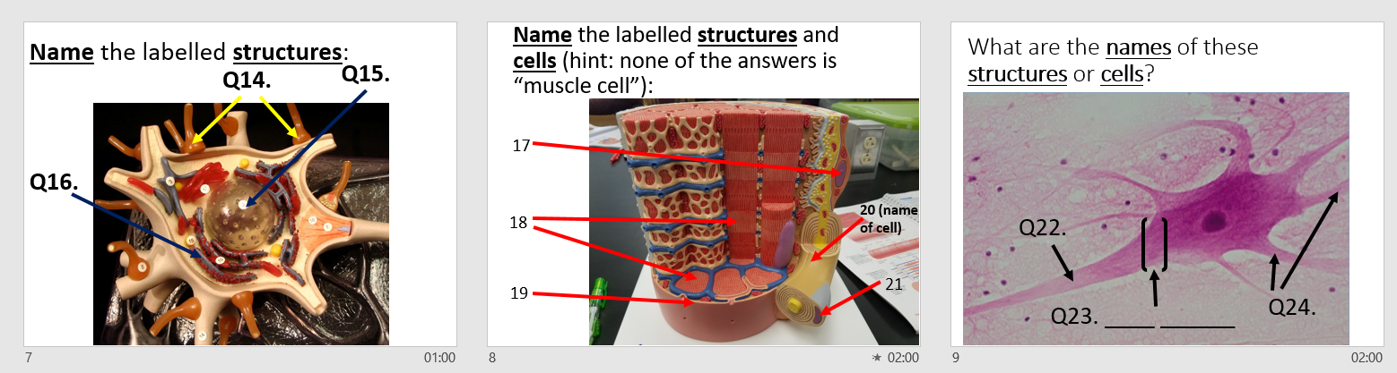 Solved Name the labelled structures: Q14. Q15. Name the | Chegg.com