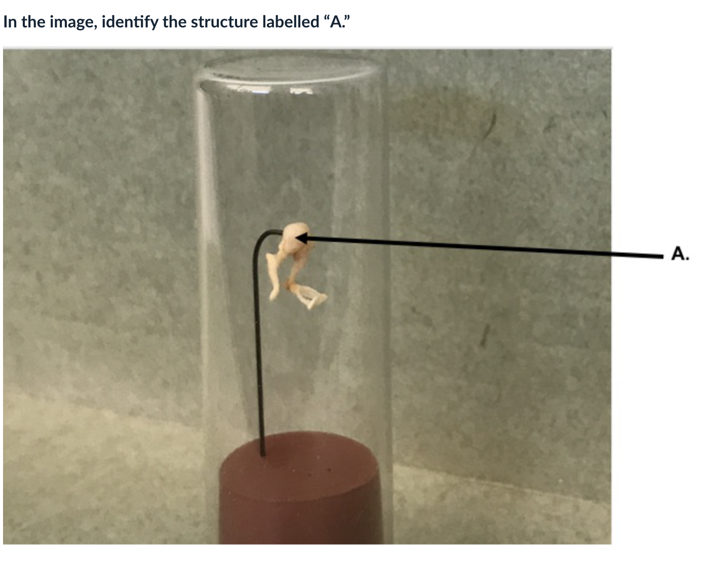 In the image, identify the structure labelled "A." | Chegg.com