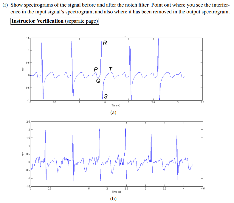 2.4 Notch Filter Removes Sinusoidal Interference The | Chegg.com