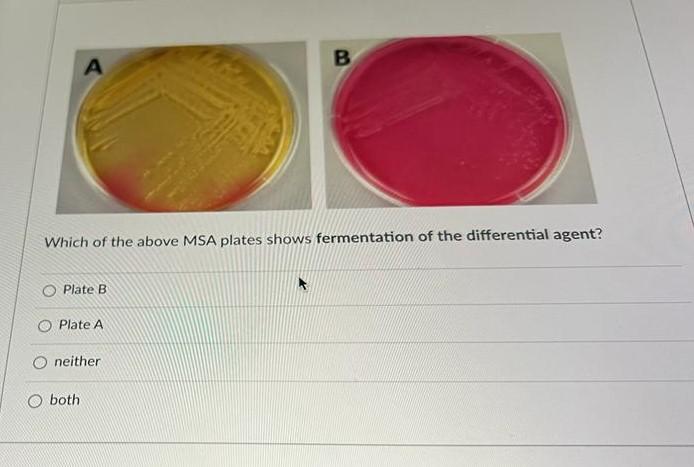 Solved B A Which of the above MSA plates shows fermentation | Chegg.com