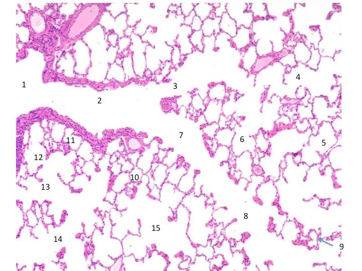 Solved IDENTIFY THE NUMBERED AREAS. 1. 2. 3. 4. 5. 6. | Chegg.com