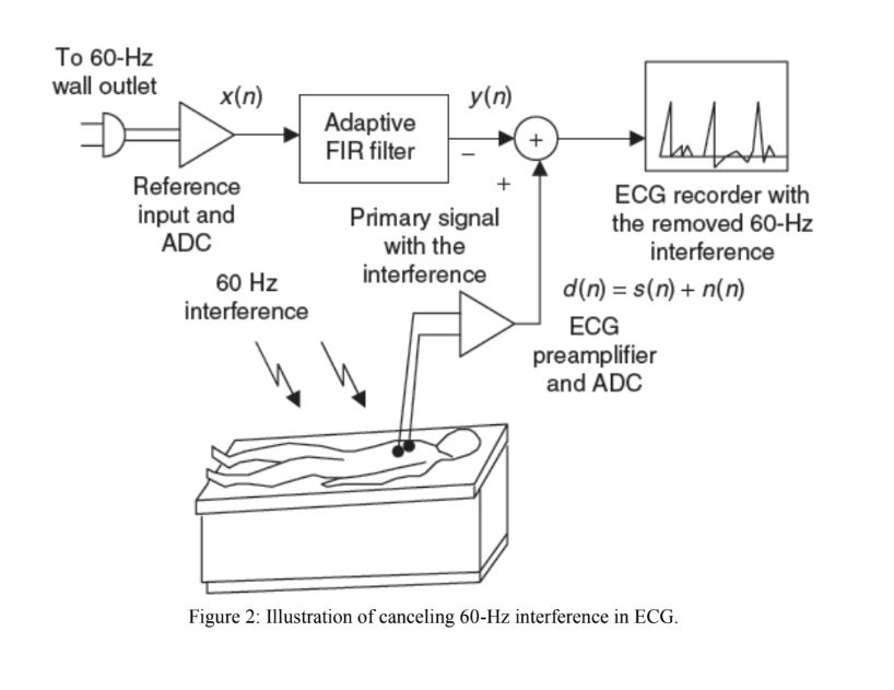 Solved In a noisy ECG acquisition environment, the DSP | Chegg.com