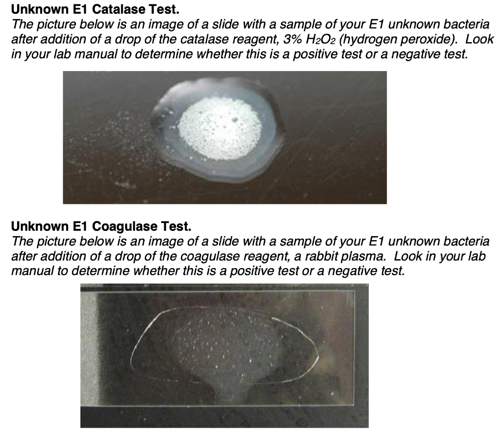Solved Unknown E2 inoculated in an Enterotube Il and | Chegg.com