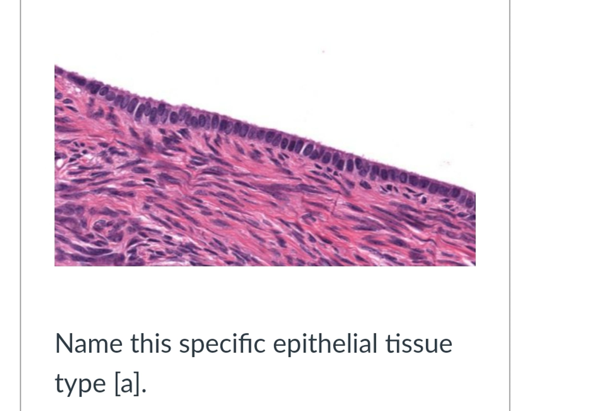Solved Name this specific epithelial tissuetype | Chegg.com