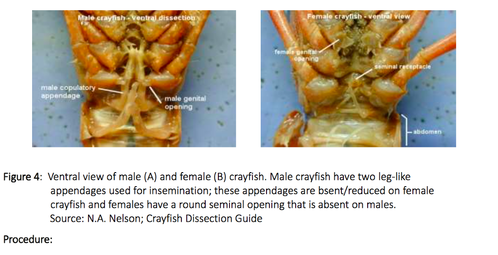 Crayfish Dissection Ventral