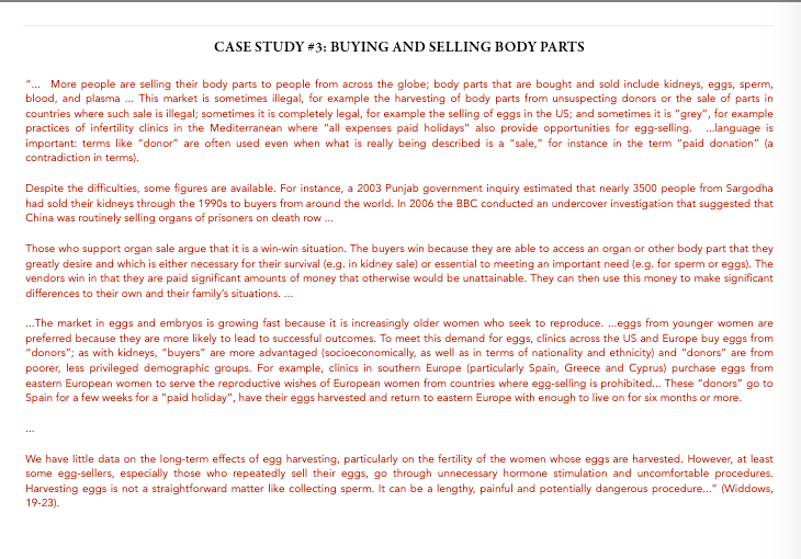Solved CASE STUDY #3: BUYING AND SELLING BODY PARTS .More | Chegg.com