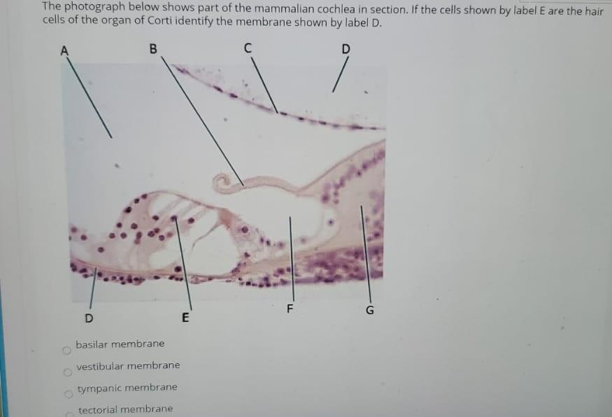 Solved The photograph below shows part of the mammalian | Chegg.com
