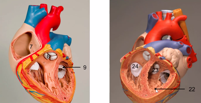 Solved 3B Medium Heart and Frey Large Heart Model Aortic | Chegg.com