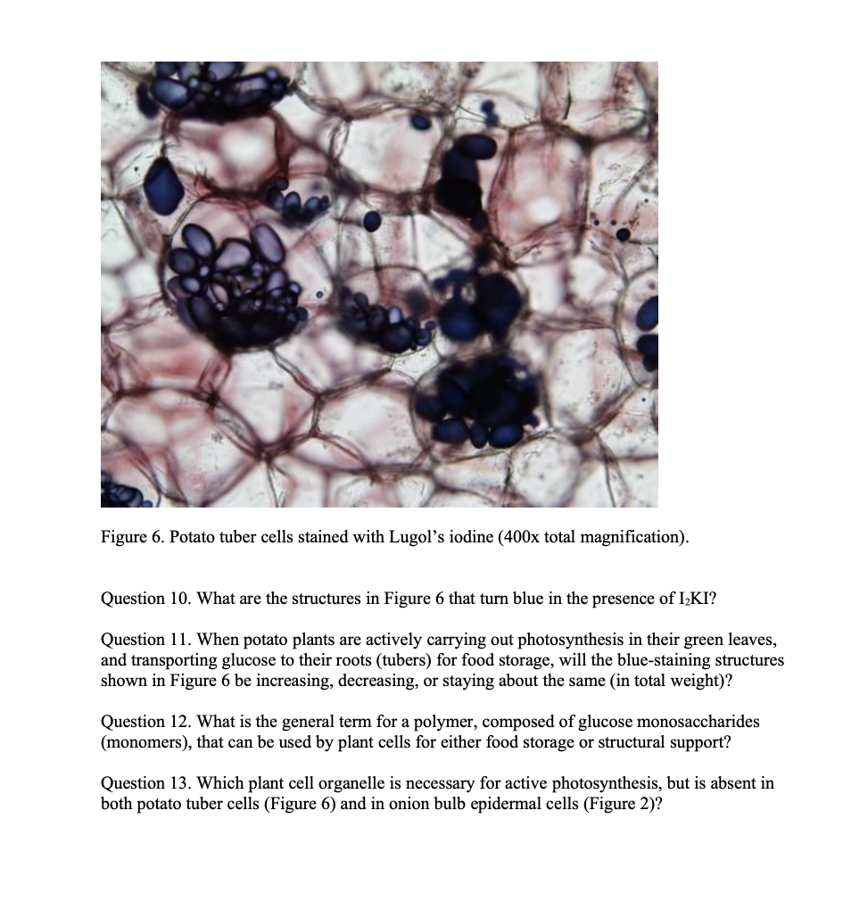 Solved Figure 6. Potato tuber cells stained with Lugol's | Chegg.com