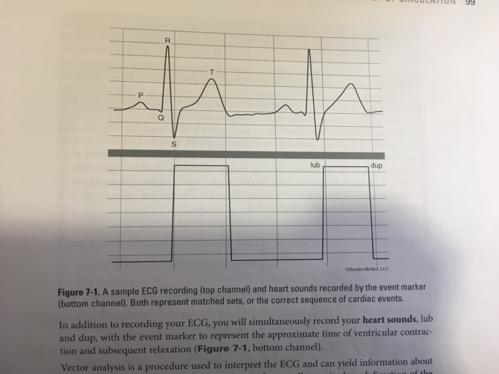 Solved Hi please use the figure 7-1 to answer all parts of | Chegg.com Solved Hi please use the figure 7-1 to answer all parts of | Chegg.com