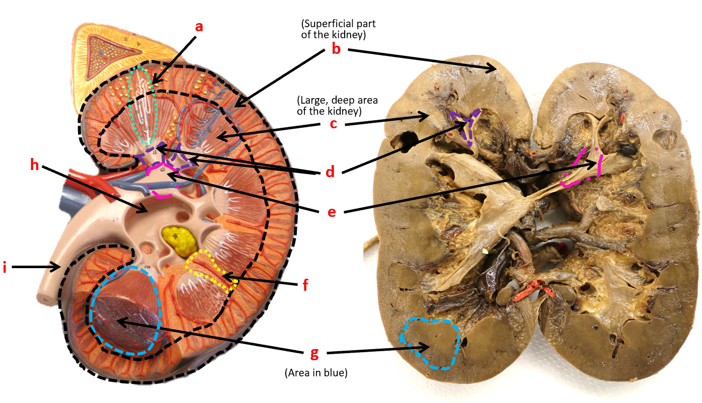 Solved Station 2: Kidney Renal Cortex Renal Medulla Renal | Chegg.com