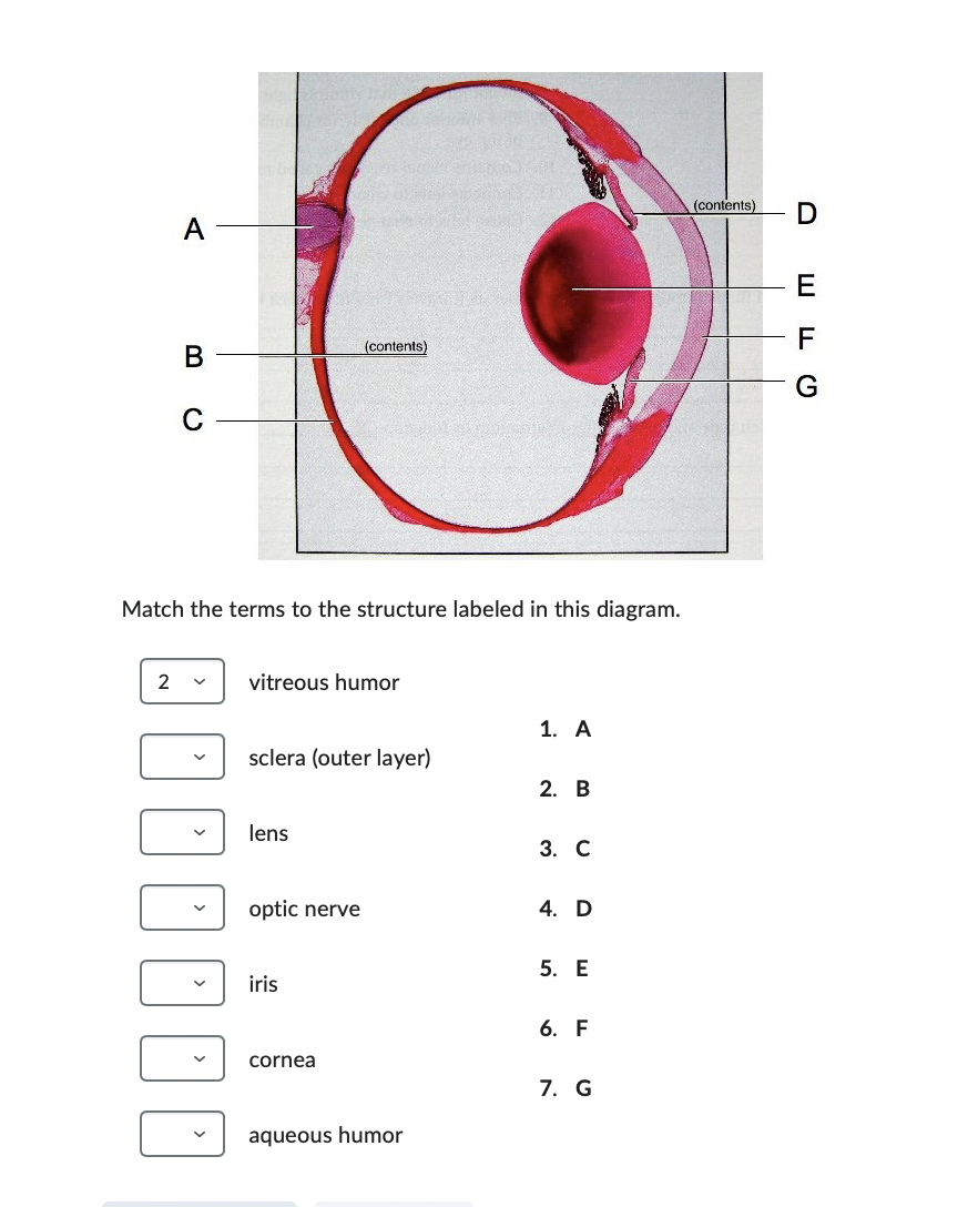 Solved Please help me match the first pic and check to help | Chegg.com