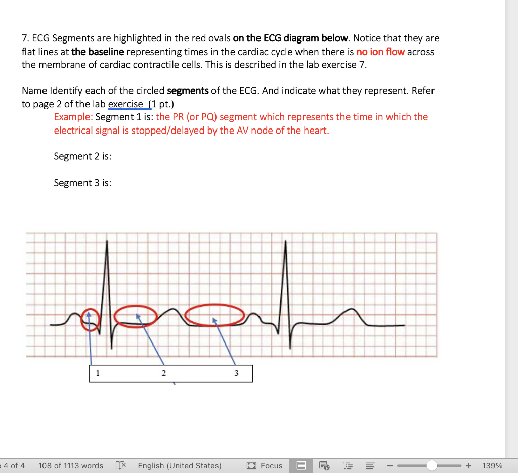Solved 7. ECG Segments are highlighted in the red ovals on | Chegg.com
