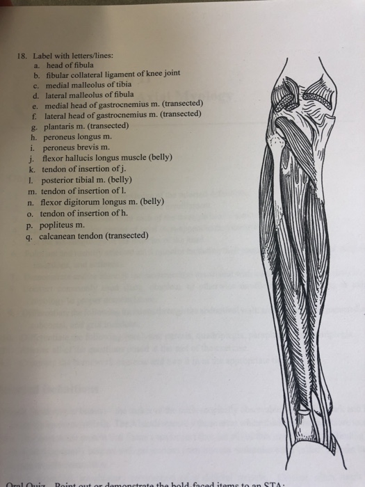 Solved 18. Label with letters/lines: a. head of fibula b. | Chegg.com