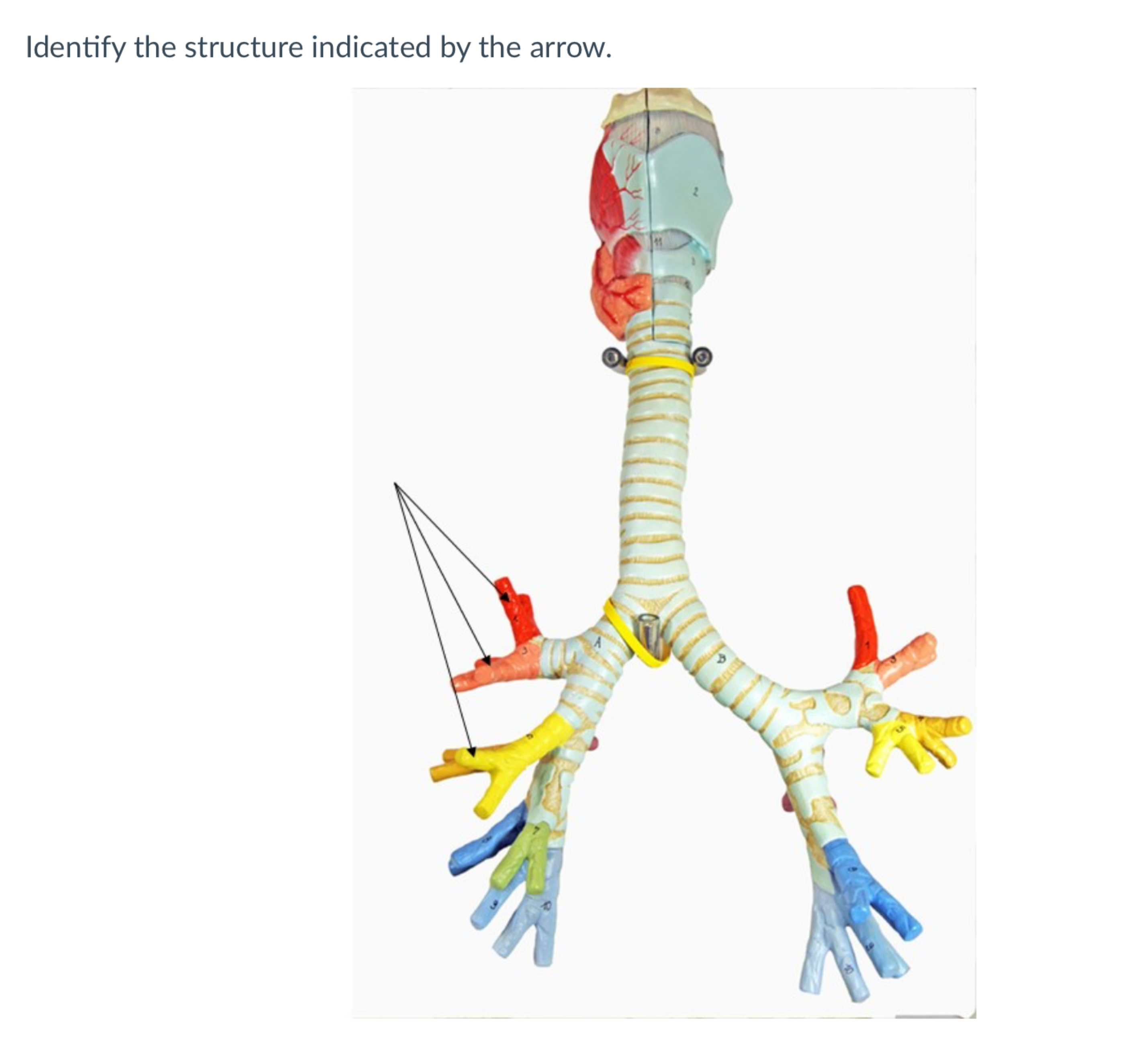 Solved Identify the structure indicated by the arrow. | Chegg.com