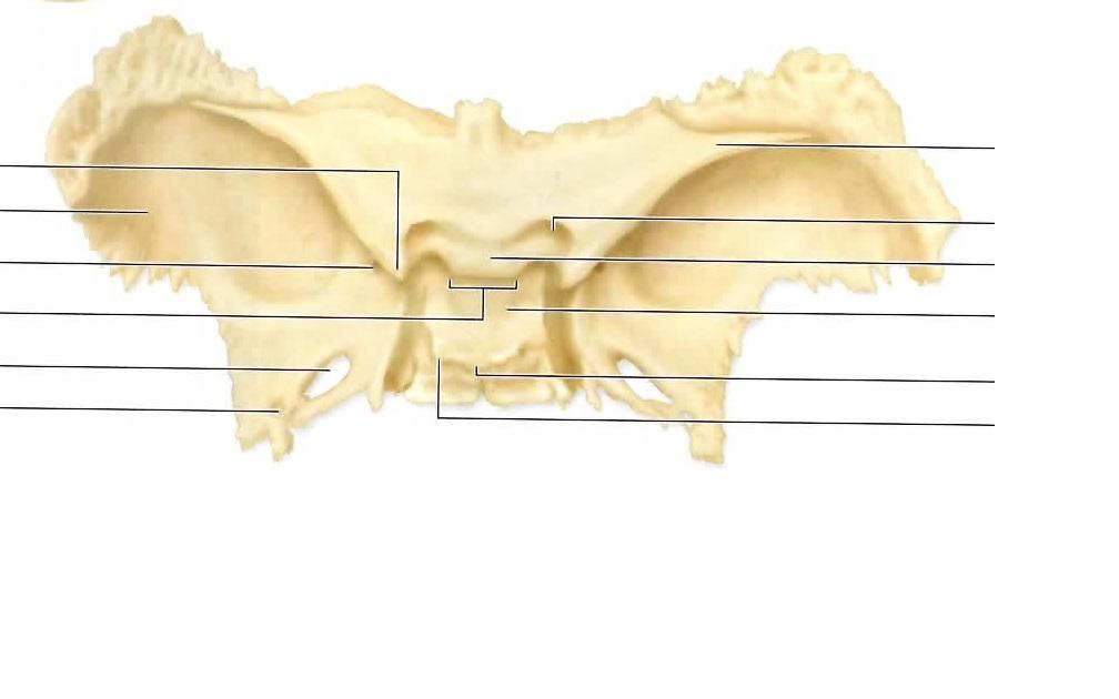 Sphenoid Bone Unlabeled