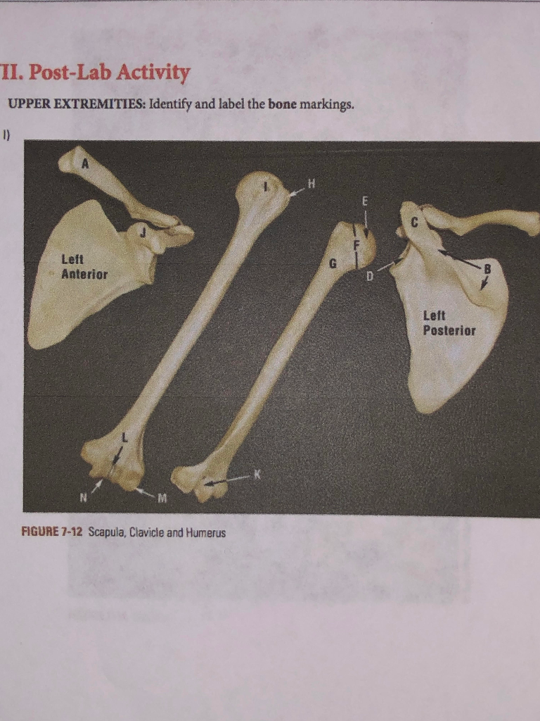 Solved C. LOWER EXTREMITIES: Identify and label the bone | Chegg.com