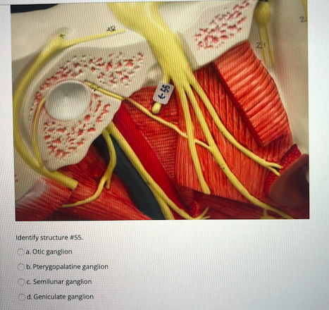 Solved 2 28 Identify structure #55. a. Otic ganglion b. | Chegg.com
