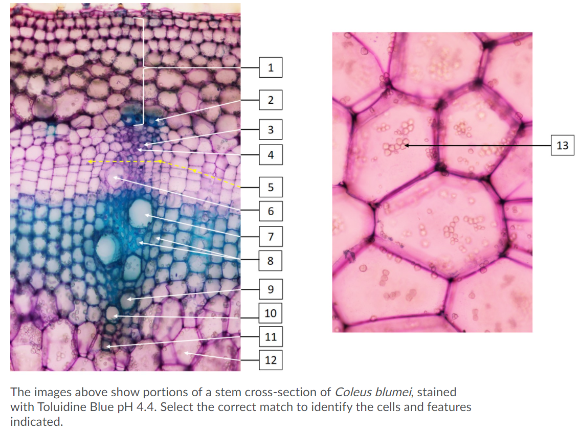 Solved 1 2 3 13 4 5 6 7 8 9 10 11 12 The images above show | Chegg.com