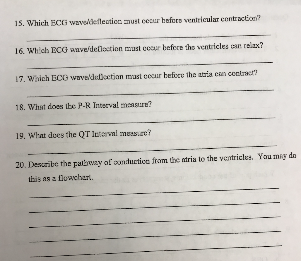 Solved 15. Which ECG wave/deflection must occur before | Chegg.com