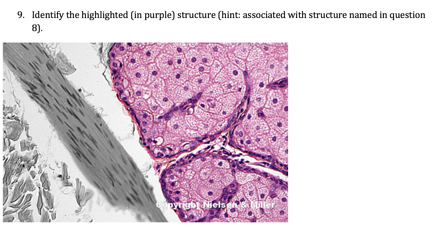 Solved 9. Identify the highlighted (in purple) structure | Chegg.com