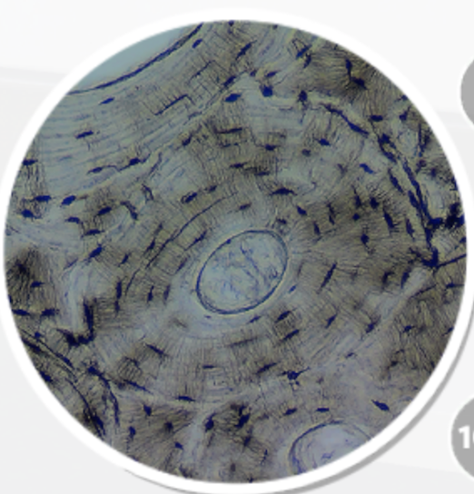 Solved Label the following structures: osteon, | Chegg.com