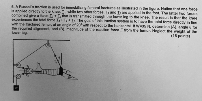 Solved A Russell's traction is used for immobilizing femoral | Chegg.com