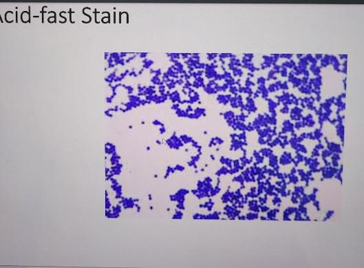 Solved Acid-fast stain Data i. Include a description of the | Chegg.com