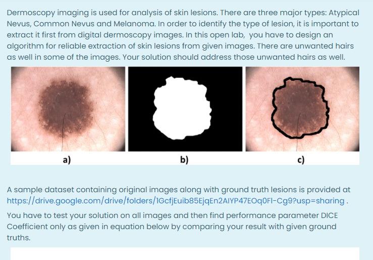 Solved Dermoscopy imaging is used for analysis of skin | Chegg.com
