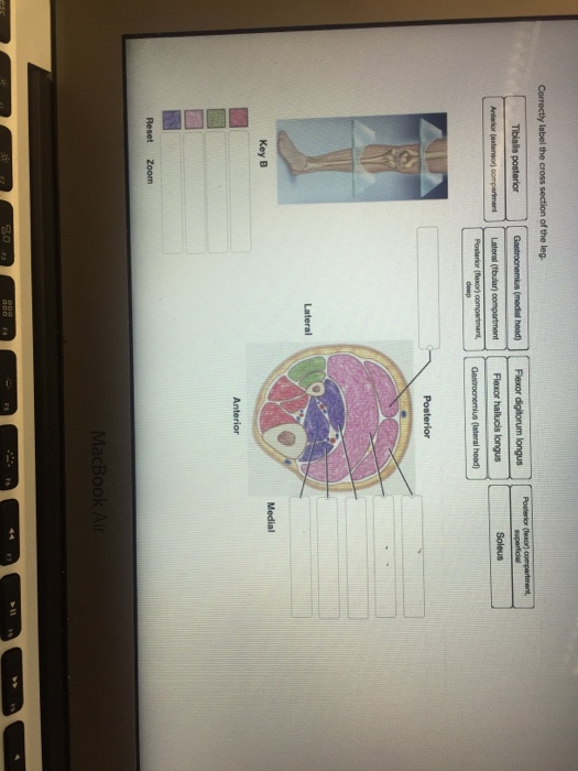 Solved Correctly label the cross section of the legs. | Chegg.com
