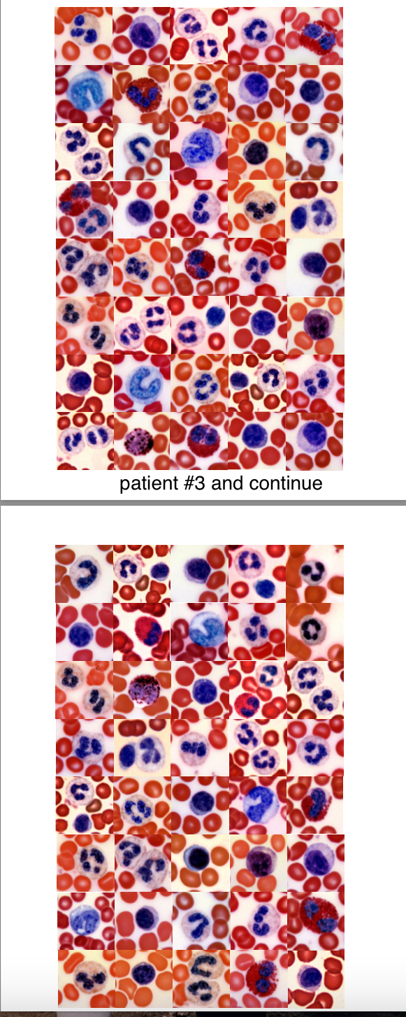 Warning! Do not go through and count all the | Chegg.com