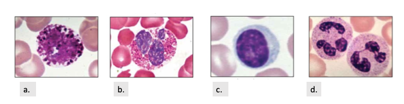 Solved Identify the subclass of leukocyte (there are only | Chegg.com