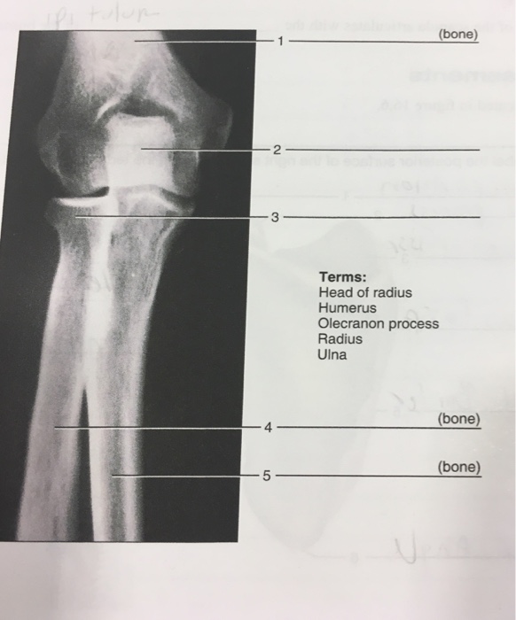 Solved 5 2 7 8 3 Terms: Costal cartilage of false rib Costal | Chegg.com