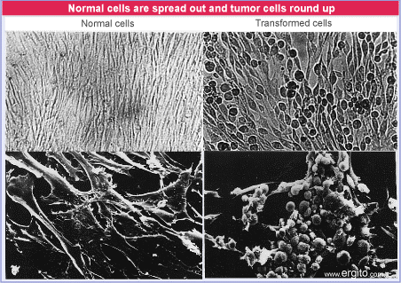 Solved “Normal” cells in culture require serum, contact with | Chegg.com