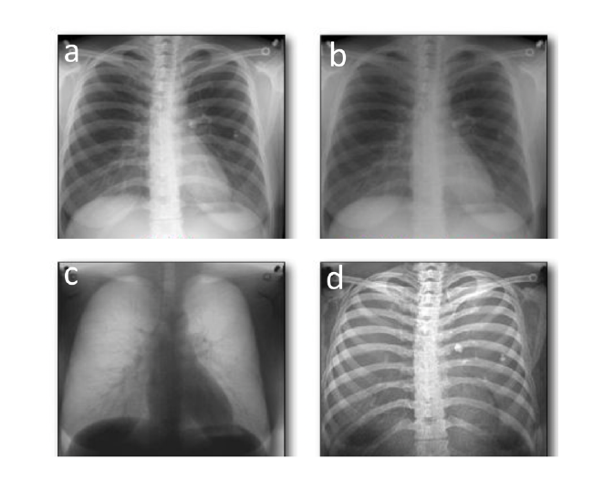Solved b) In general, an X-ray radiograph is a | Chegg.com