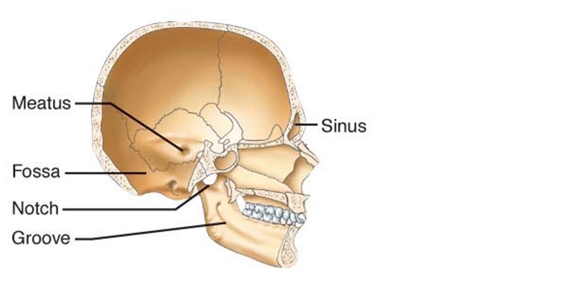 Sinus Bone Marking