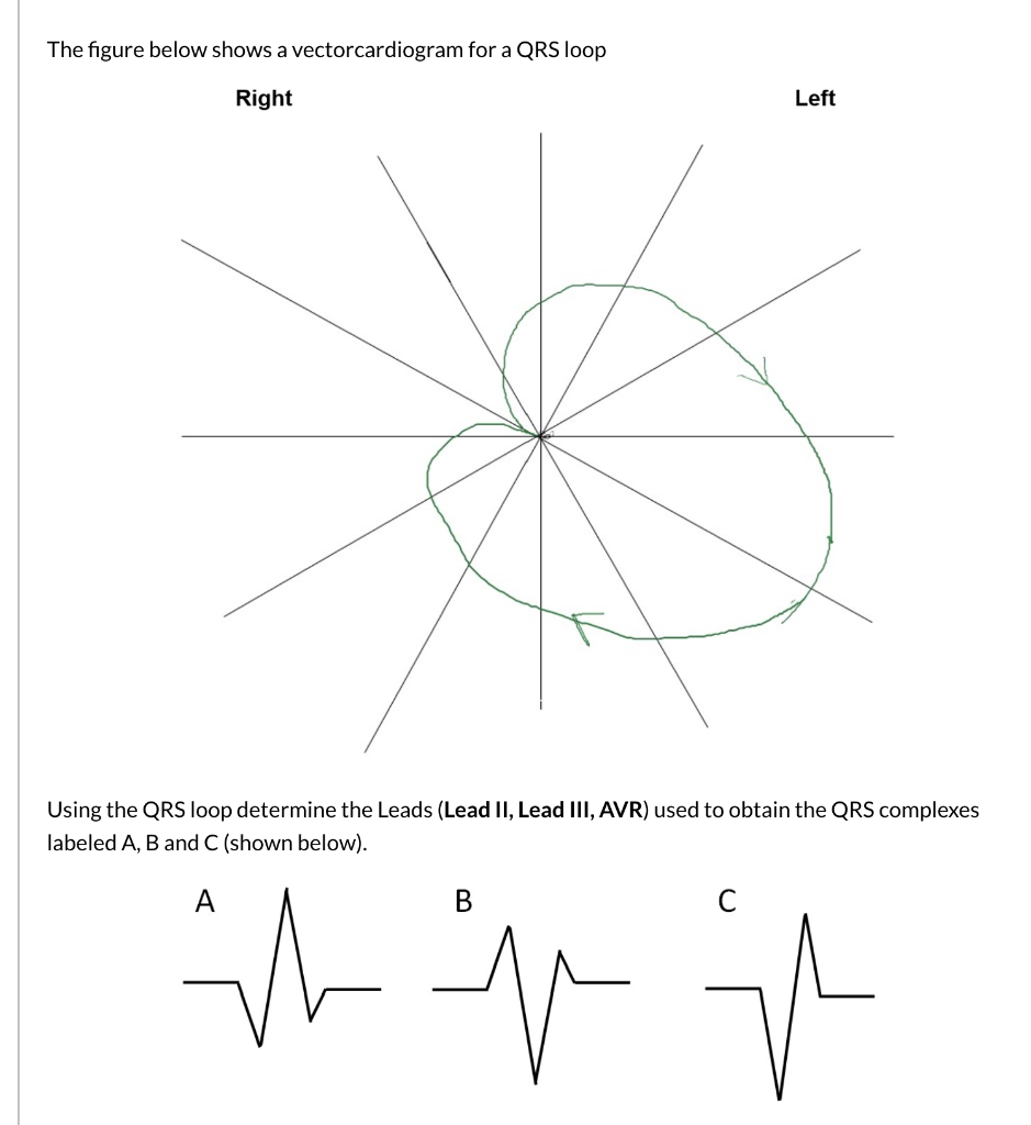 Solved The figure below shows a vectorcardiogram for a QRS | Chegg.com