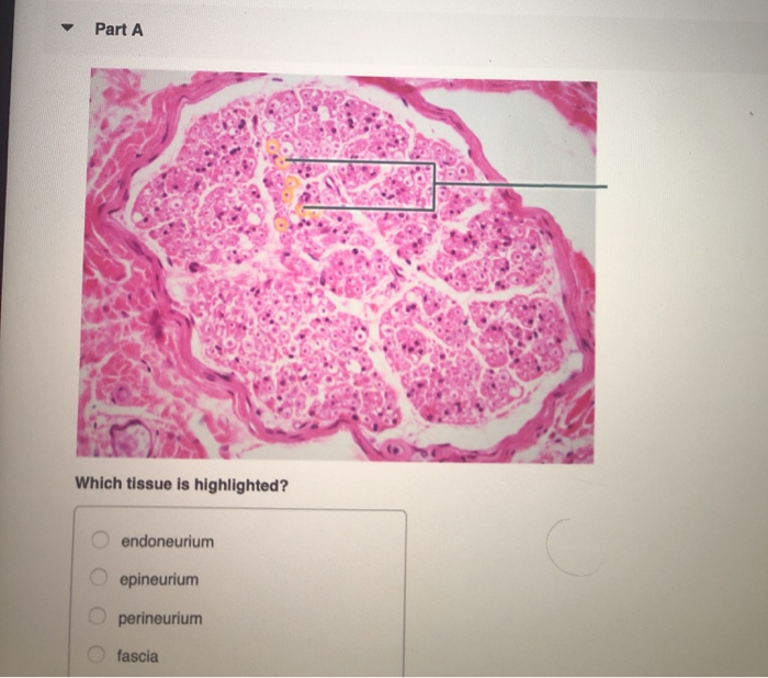 Solved Part A Which tissue is highlighted? endoneurium | Chegg.com
