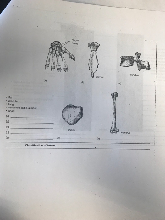 Solved b) flat . irregular long sesamoid (SES-a-moid) short | Chegg.com