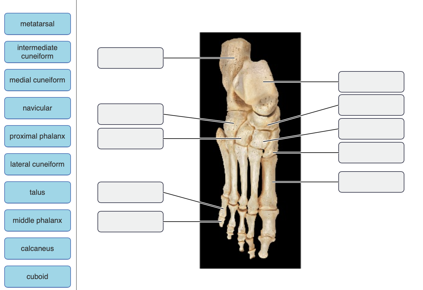 Solved metatarsal intermediate cuneiform medial cuneiform | Chegg.com
