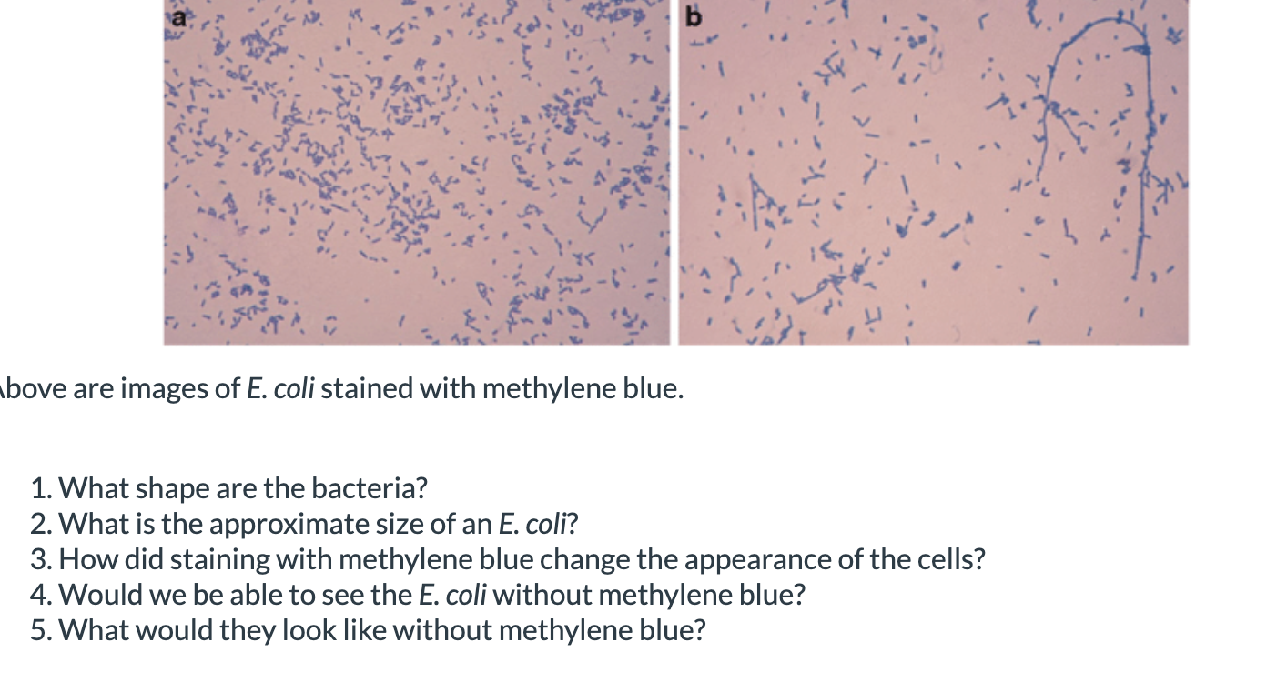 Solved bove are images of E. coli stained with methylene | Chegg.com