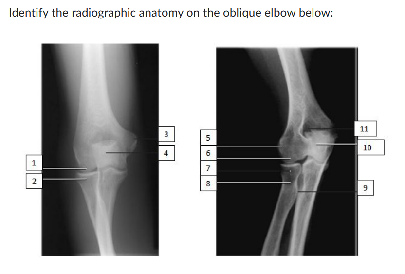 Solved Identify the radiographic anatomy on the oblique | Chegg.com