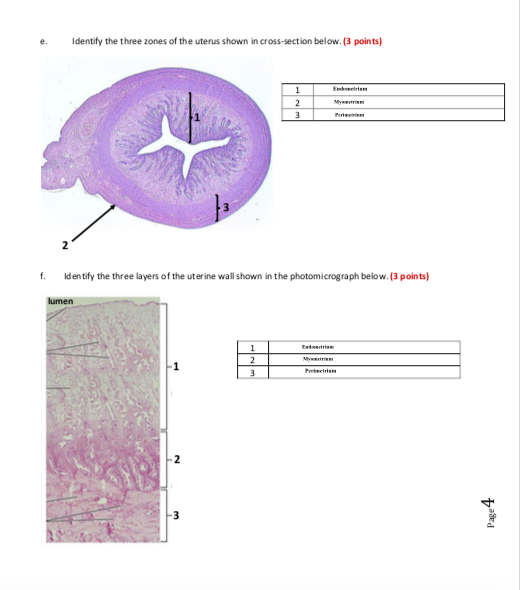 Solved Identify the numbered structures below in the | Chegg.com