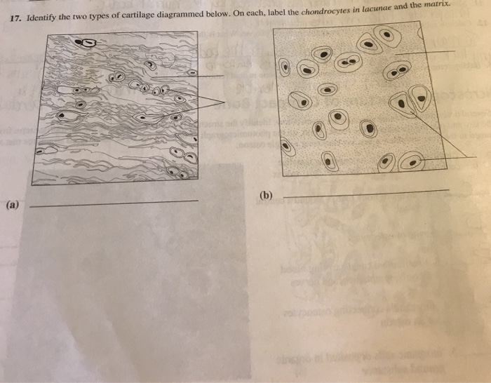 Solved 17. Identify the two types of cartilage diagrammed | Chegg.com