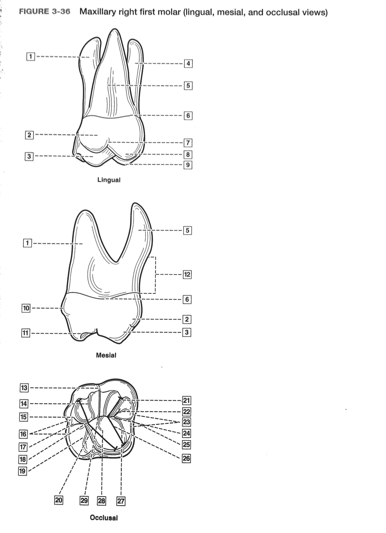 Solved dental anatomy for Maxillary right first molar | Chegg.com