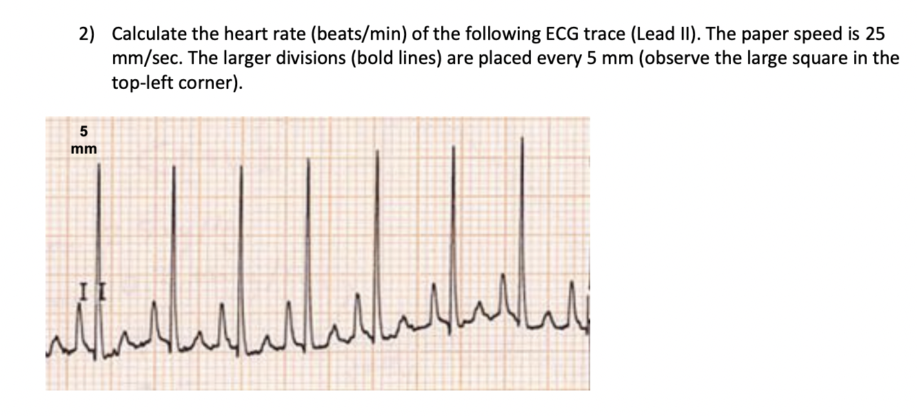 Solved 2) Calculate the heart rate (beats/min) of the | Chegg.com